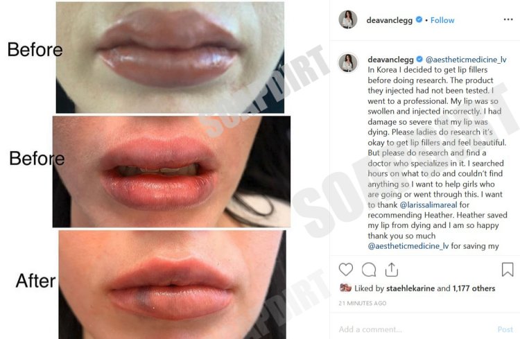 '90 Day Fiance': Deavan Clegg Unrecognizable after Teeth and Lips Fixed ...